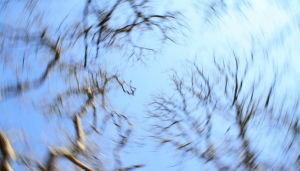 Dizzy While Driving? Check Your Eyes for BVD (Binocular Vision ...